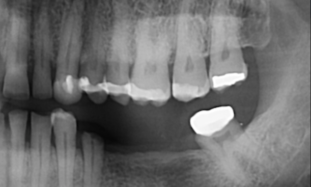 Elk Grove CA Dentist | Before & After Photos